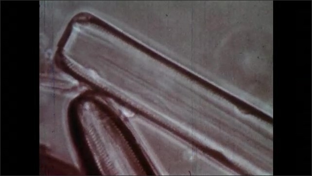 1960s: UNITED STATES: pattern of algae under microscope. Red tide in ...