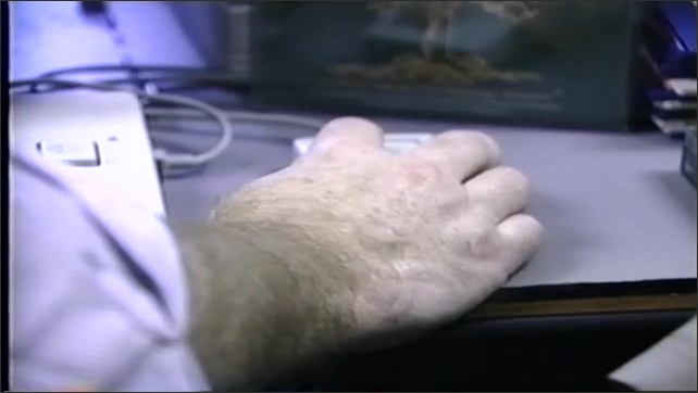 1990s: X-ray of lungs on computer screen. Text, images on computer ...